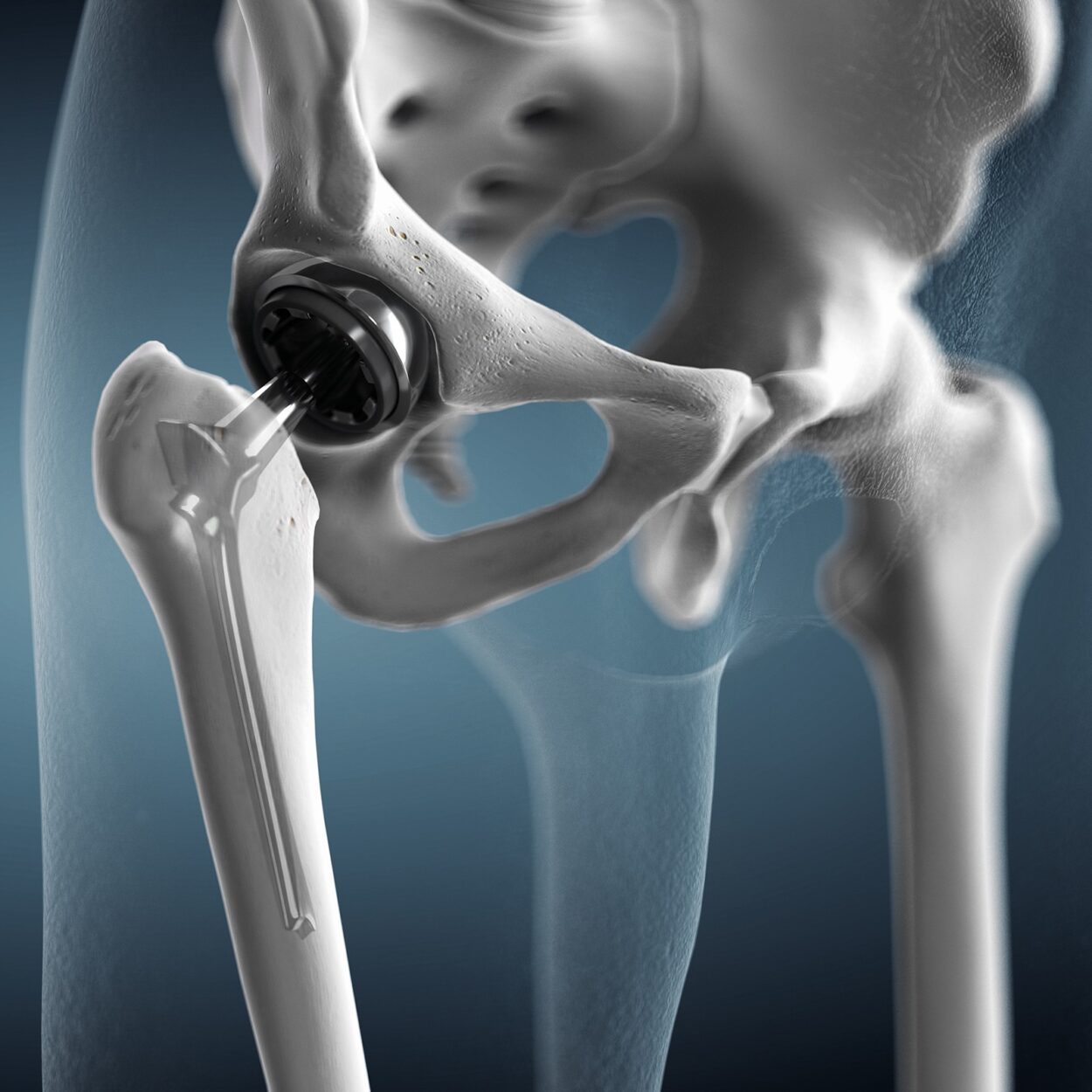Countries with Developed Geothermal Energy - Havannah Health